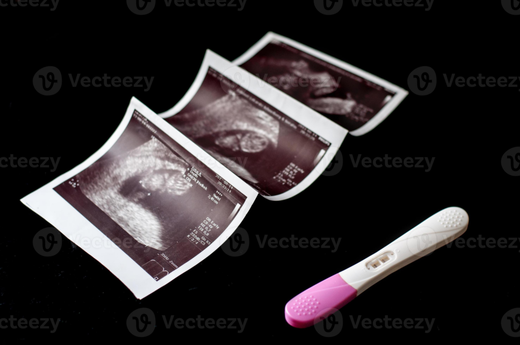 Baby Ultrasound Scan Packages in Holbrook, NY | A Glimpse of Me